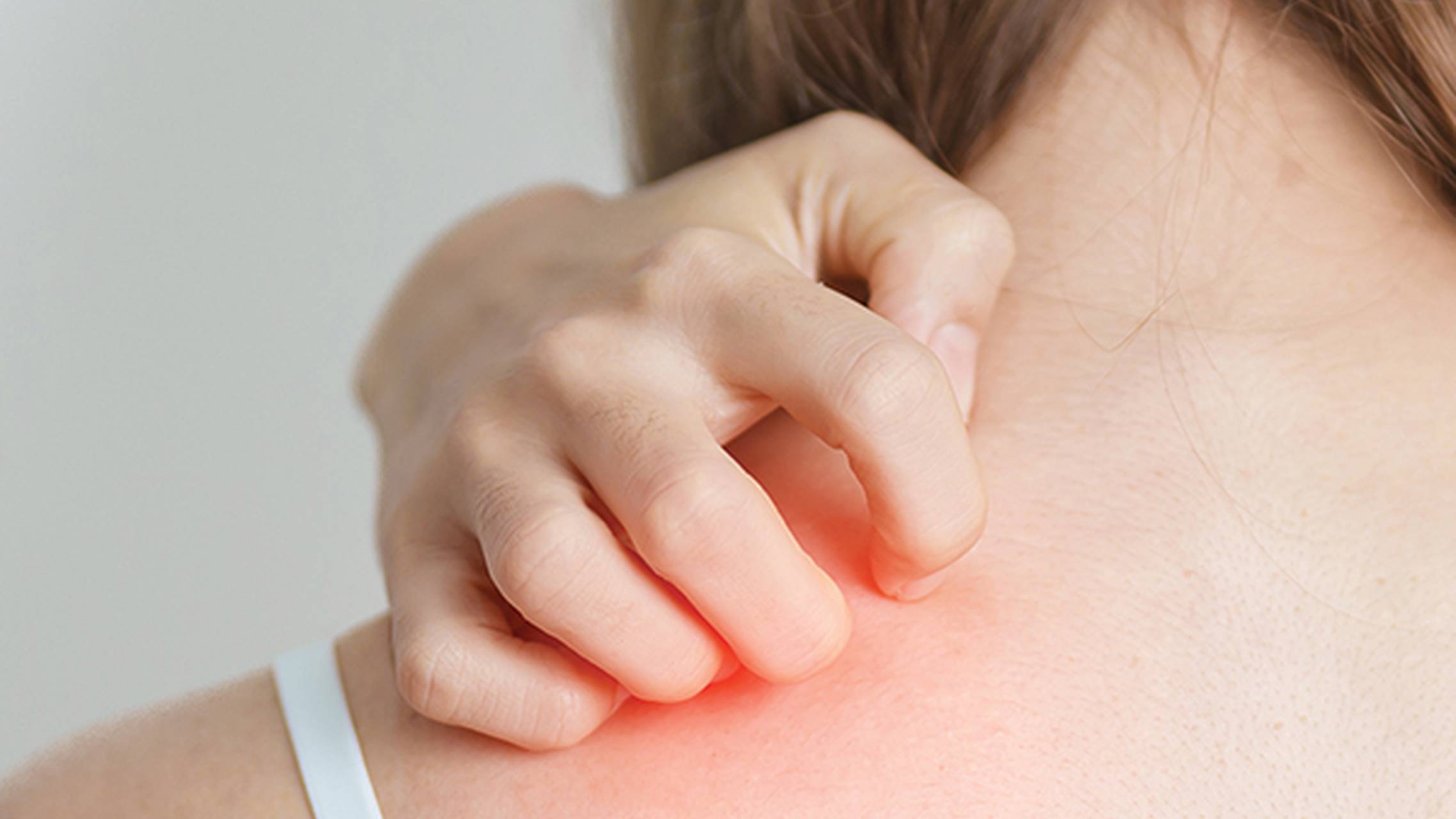 Drs. Yosipovitch and Kim on the latest in the world of itch