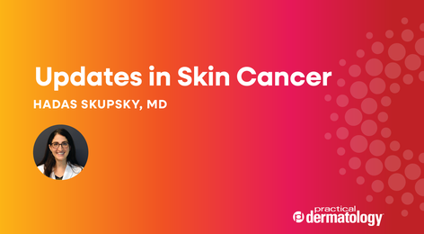 Updates in Skin Cancer: Importance & Utility of GEP Testing