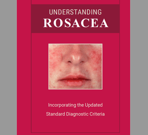 NRS Launches Updated Version of "Understanding Rosacea" for Patients ...