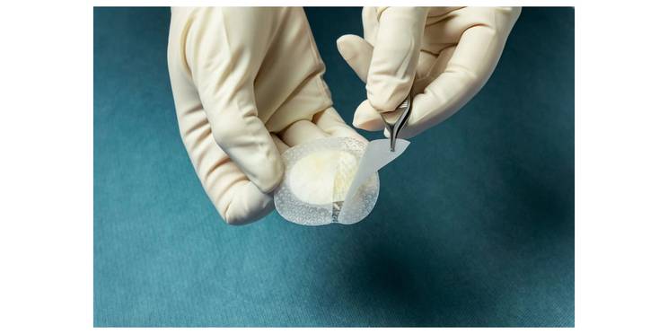 New Kerecis Medical-Fish-Skin Product Approved by Medicare ...