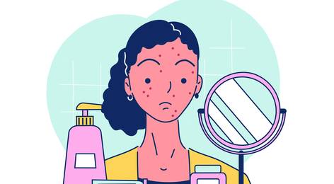 Rosacea: A Closer Look at the Latest Treatment Options