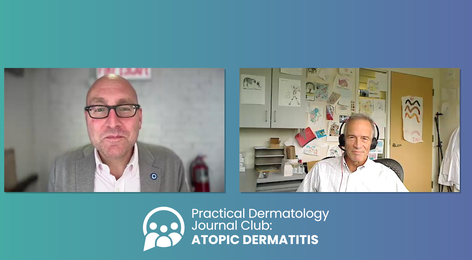 AD: Unveiling New Insights in Cause & Treatment