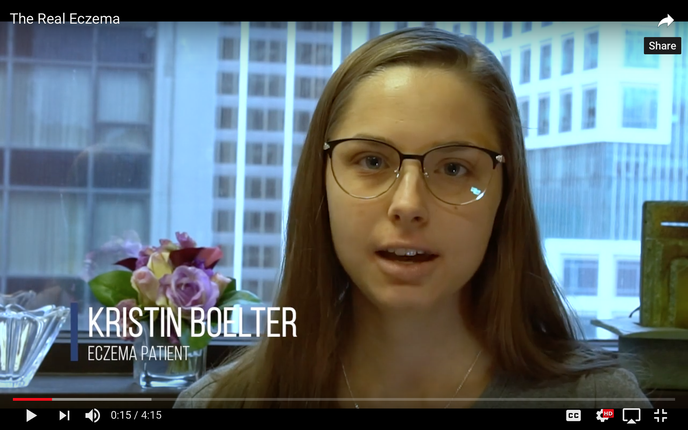 National Eczema Association's New Campaign Exposes The “Real Eczema ...