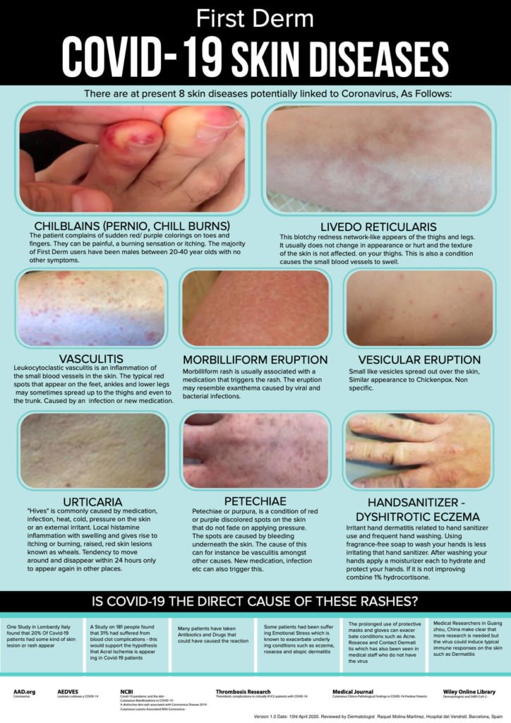 New Infographic Compares Rashes to COVID Toes - - PracticalDermatology