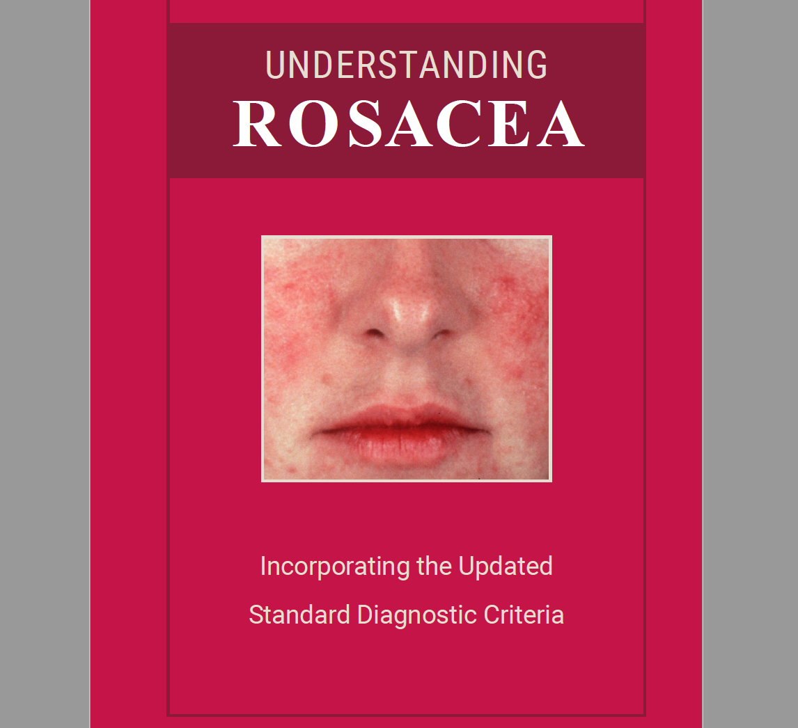 NRS Launches Updated Version of "Understanding Rosacea" for Patients ...