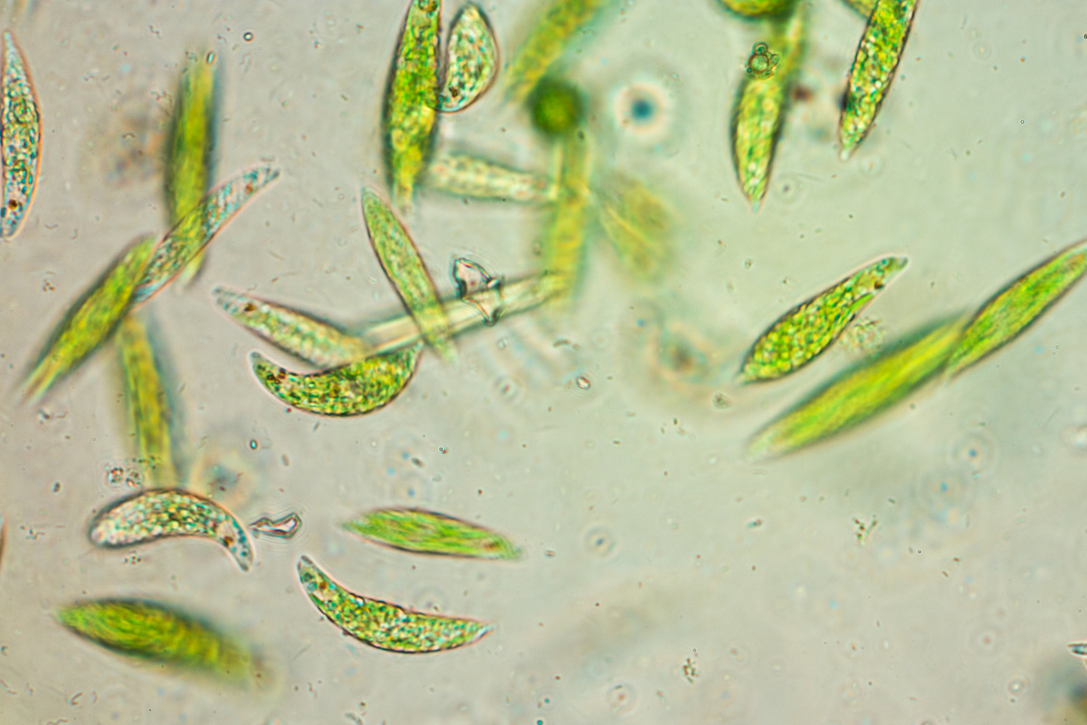 Algae May Enhance Skin Regeneration and Wound Healing: Study ...