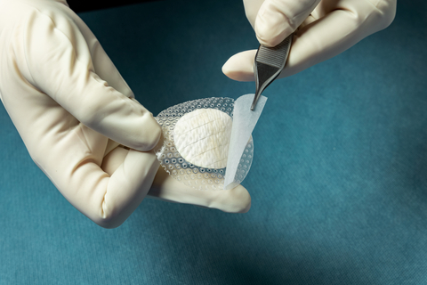 Kerecis Introduces Fish-Skin Graft and Silicone Cover for Wound ...