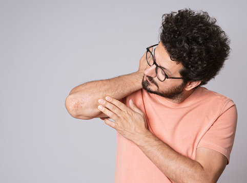 Zasocitinib Demonstrates Biologic-Level Efficacy in Psoriasis ...