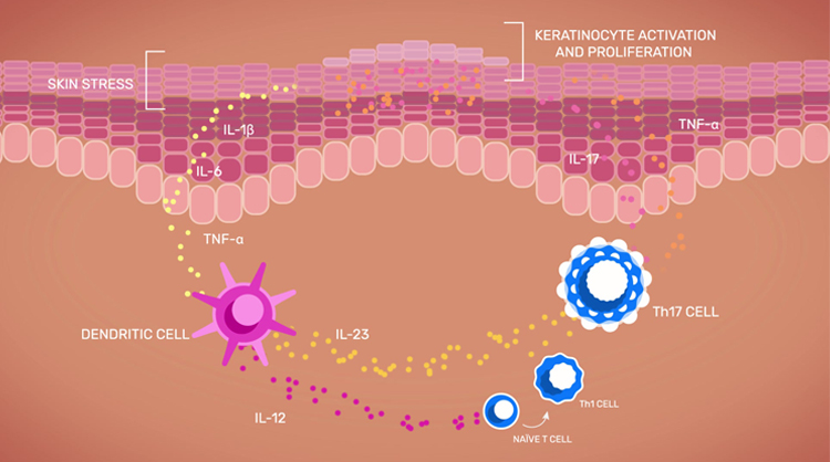 See how ILUMYA™ works