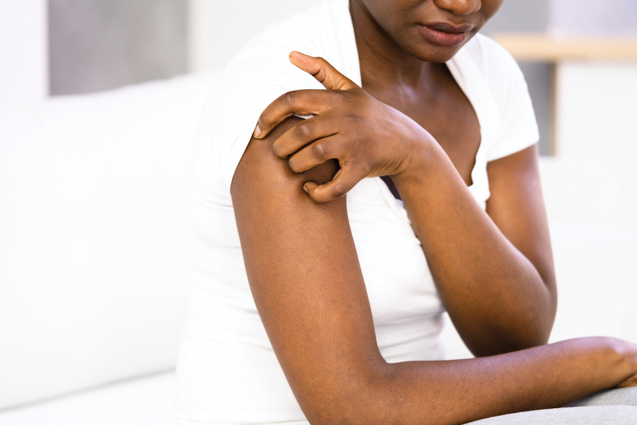 Pearls for Monitoring and Managing Itch: An Expert Panel ...