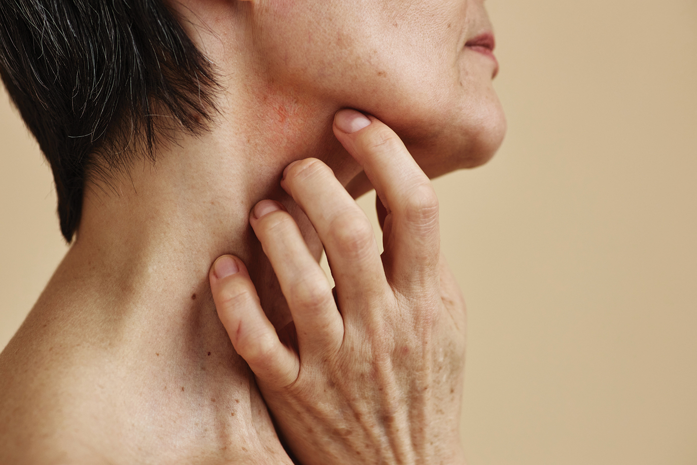 Non-Pharmacological Treatments for Skin Picking Disorder ...