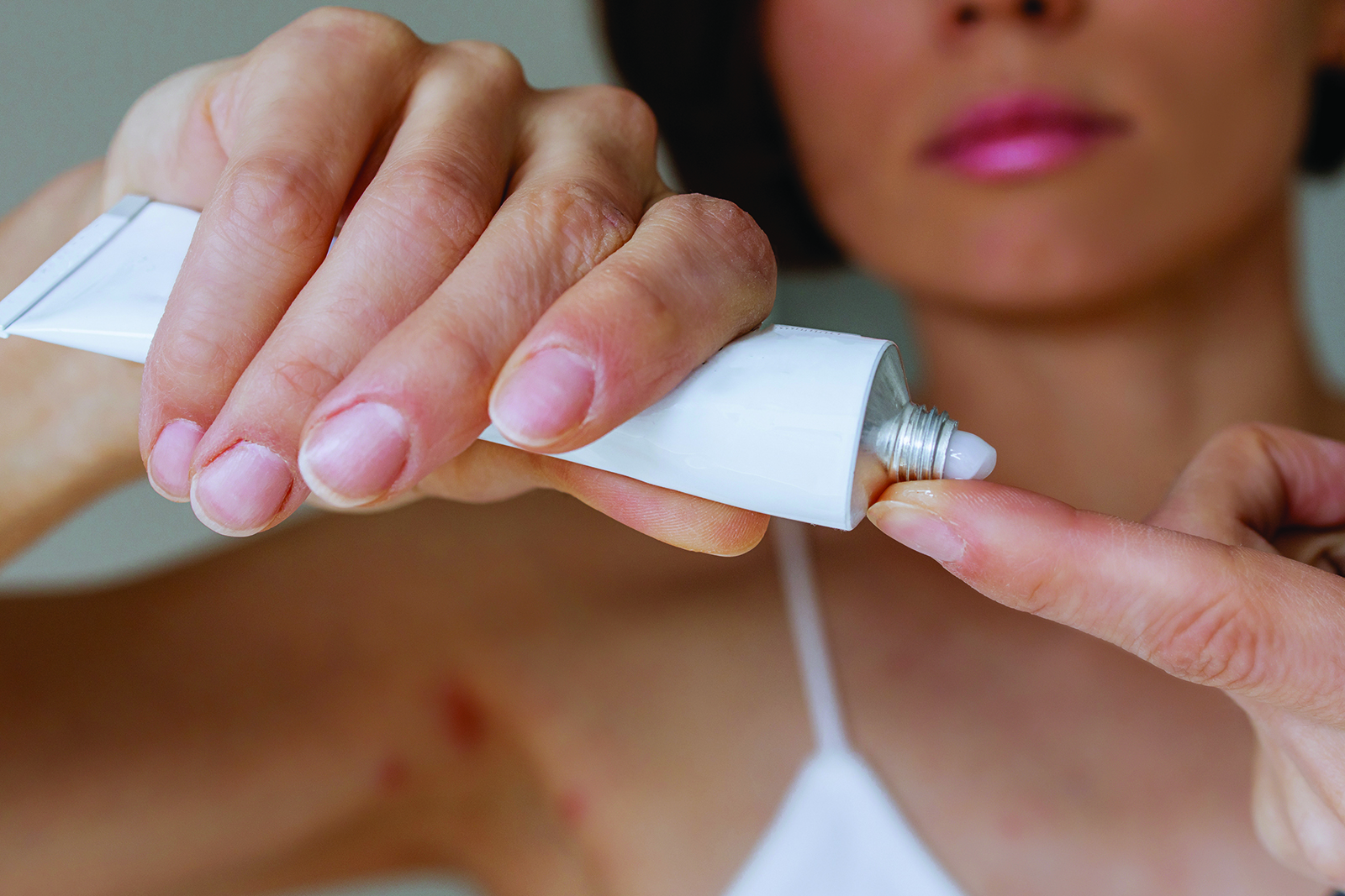 Managing Pediatric AD